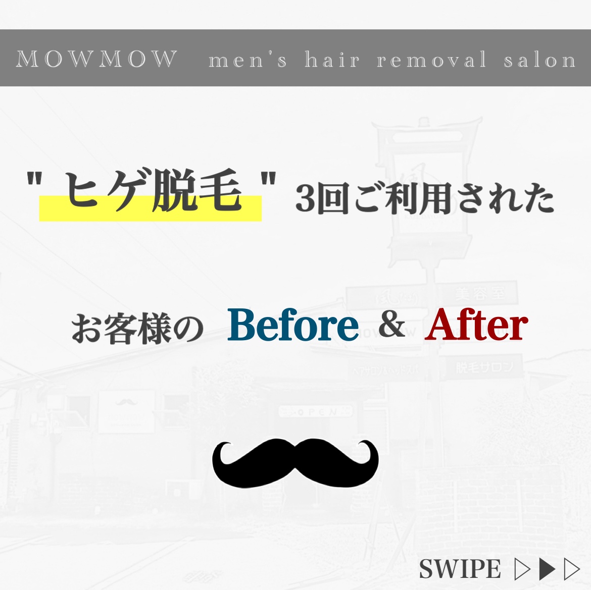 ヒゲ脱毛 Before&After | 【メンズ脱毛専門店】MOWMOW